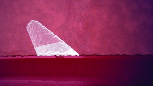 Cordis | MYNXGRIP™ Vascular Closure Device